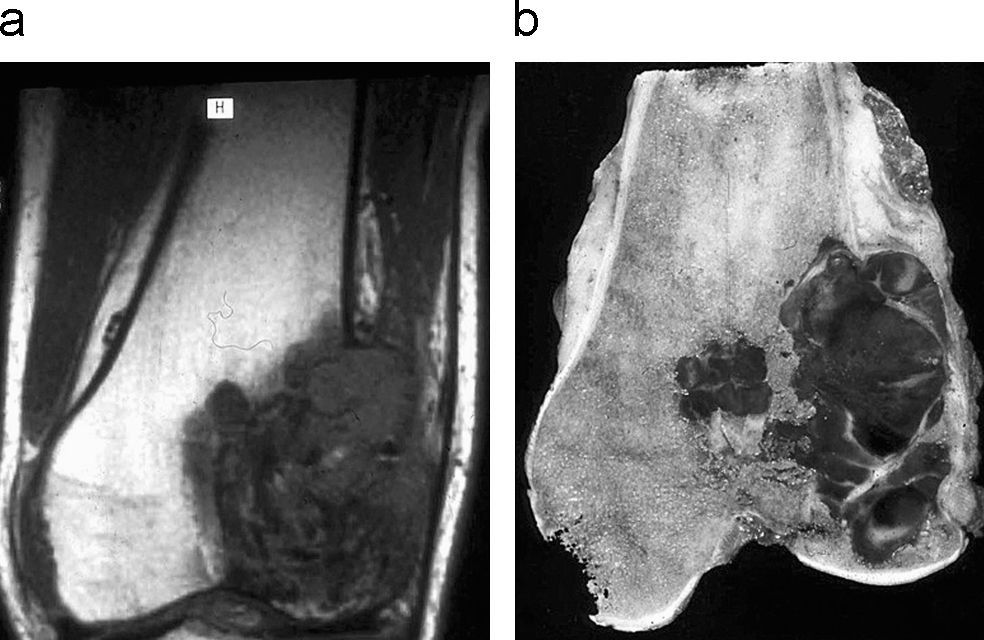Guía completa sobre tumores en hamsters: causas, síntomas y ...